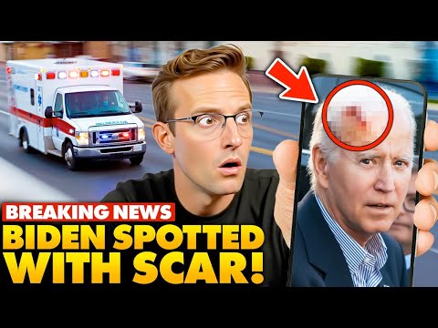 Biden’s Disturbing Injuries Raise Alarming Questions About His Health ...